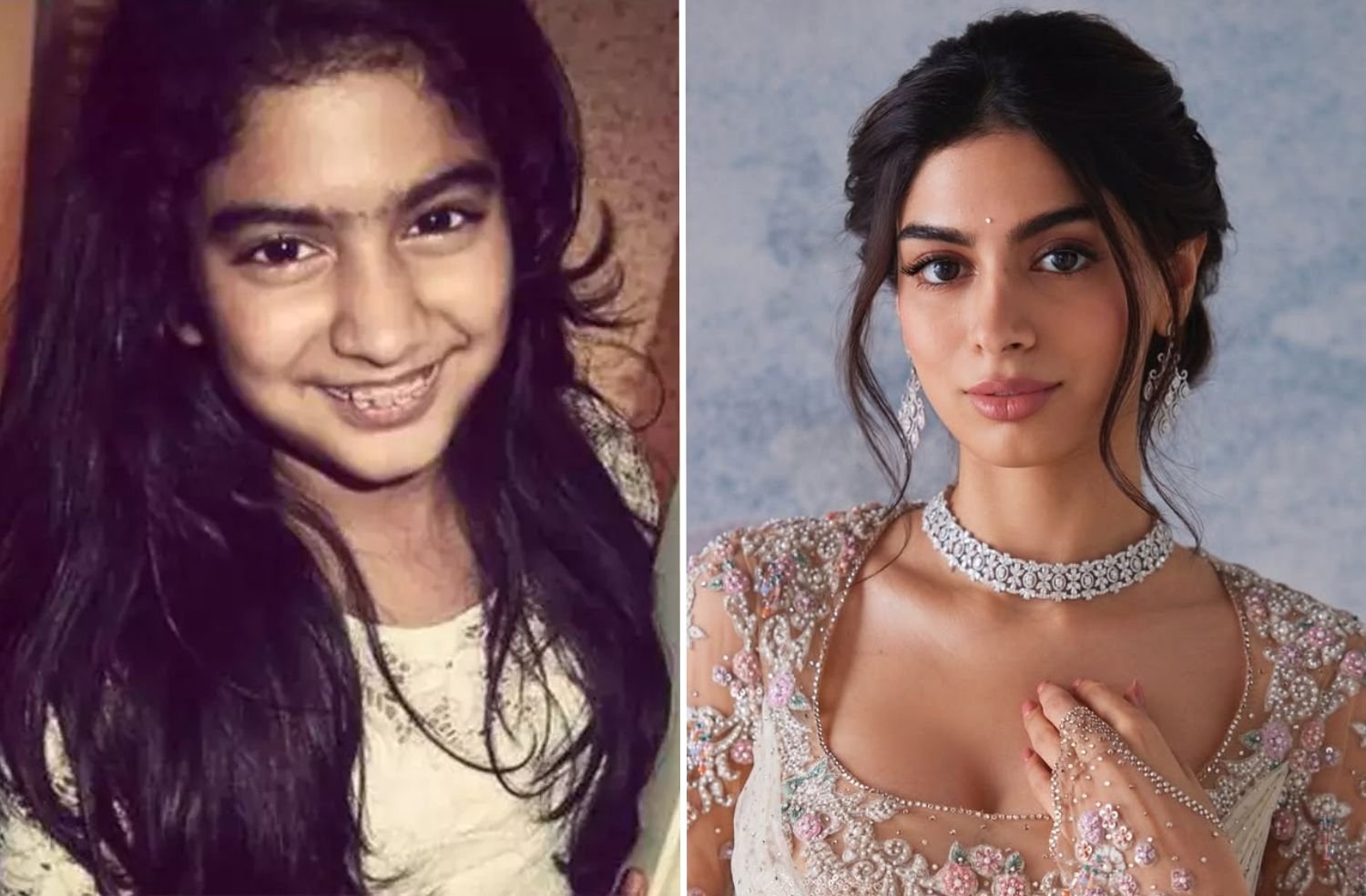Khushi Kapoor Admits To Plastic Surgery Says, “Don't Think It's Such A ...